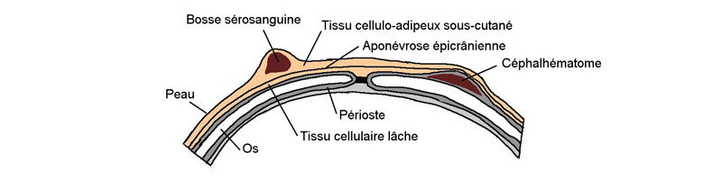 Plagiocéphalie | Ostéopathe à Noiseau (Val-de-Marne,94) | S.HEIDEN